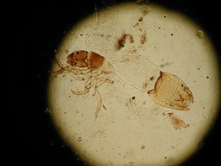 BU Research Blog | Photo of the Week: Zooming in on Dietary Differences ...