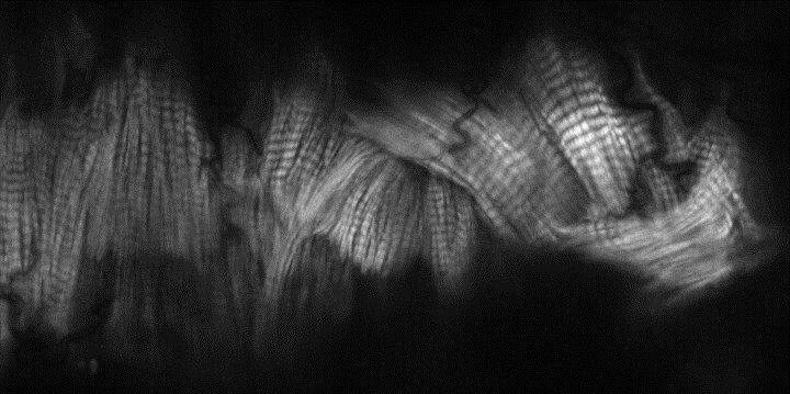 BU Research Blog | Breaking hearts at BU… | Bournemouth University